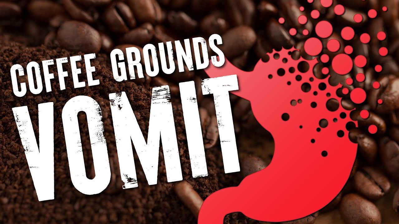 Coffee ground vomit: is your morning brew moonlighting as abstract art ...
